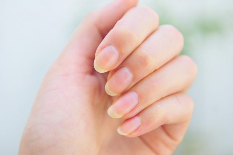 10 Surprising & Interesting Nail Health Facts You Must have to Know